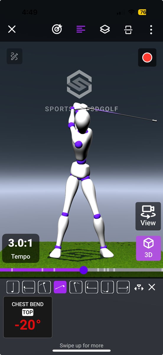 Fixing the Reverse Spine Angle